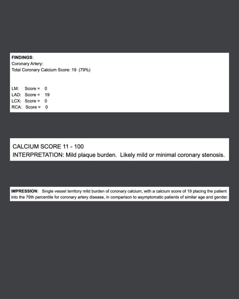 Calcium Score Test: What My Results at 53 Revealed
